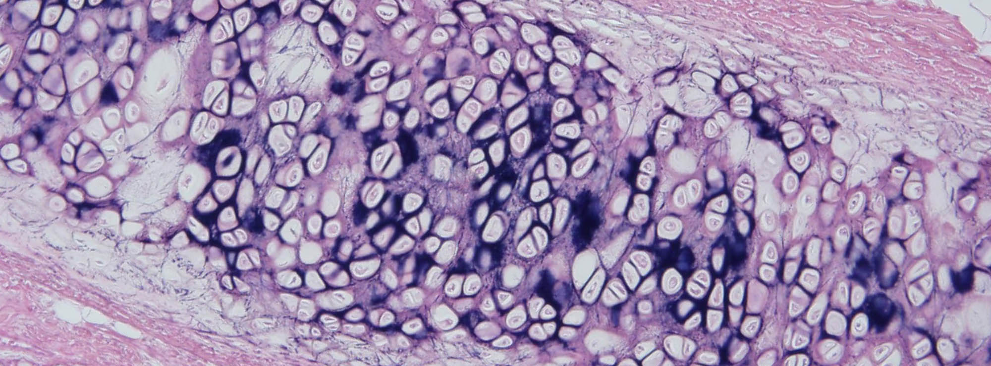 3D Printed Cartilage Breakthrough Offers Millions New Hope | 311 Institute