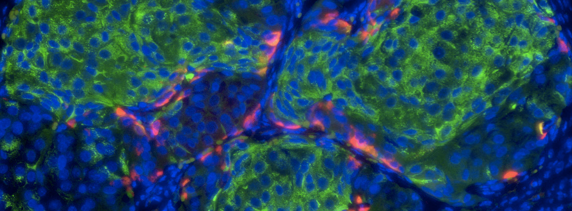 Scientists are creating a detailed map of all 35 trillion cells in the ...