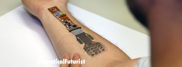 New Smart Bandage heals wounds faster and talks to your doctor - 311 ...