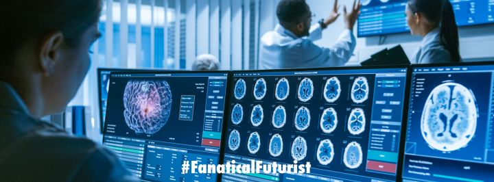 University researchers unveil the world’s first portable MRI machine ...