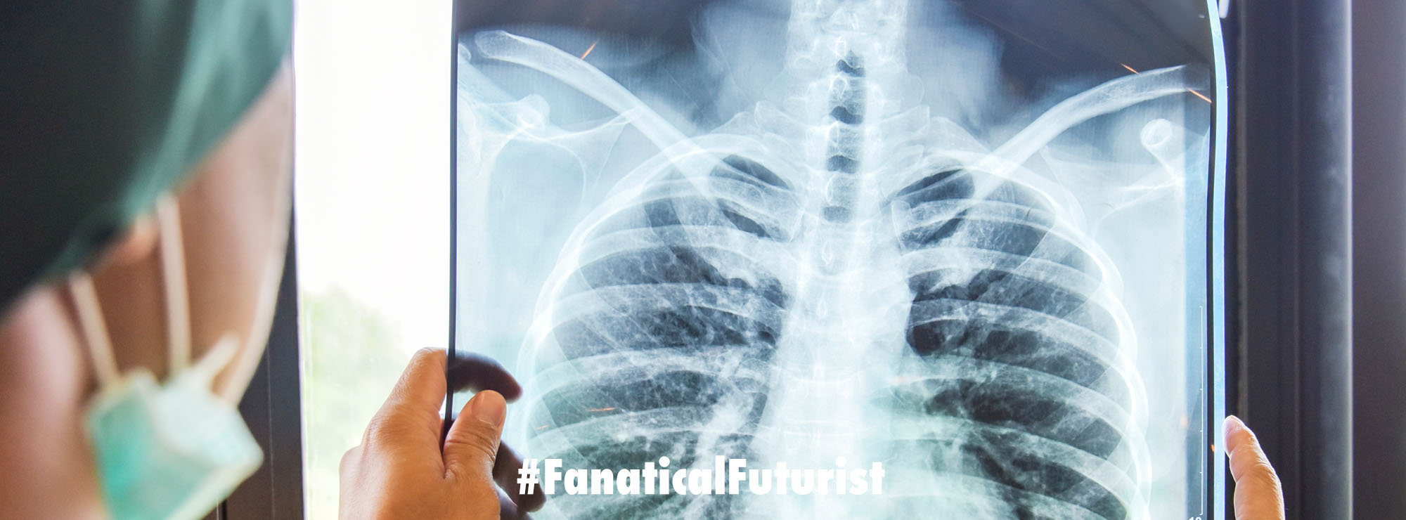 This new portable X-Ray device will let you X-Ray yourself at home ...