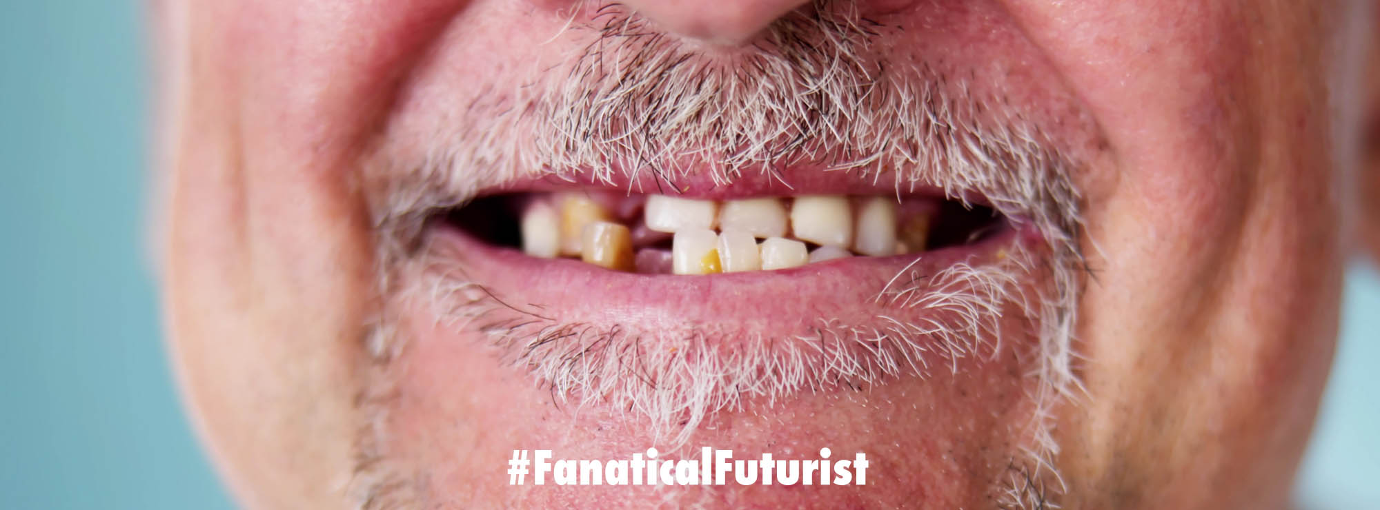 World's first drug that regrows teeth to be tried in humans - 311 Institute